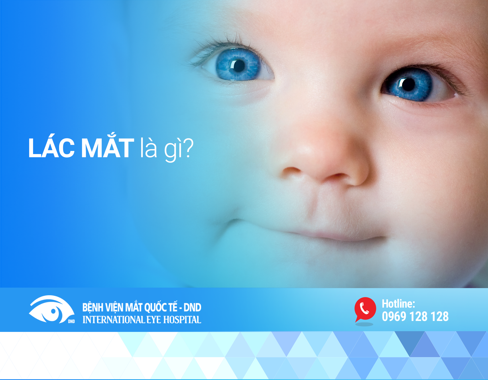Lác mắt và những hiểu biết cơ bản