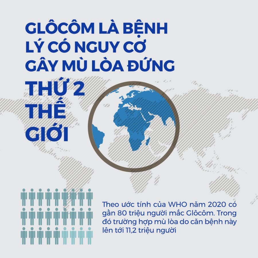 Tổng quan về Glôcôm